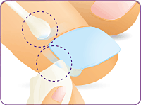 クレナフィンの使用方法 | クレナフィン爪外用液10% | 診療サポート情報 | 科研製薬 医療関係者向け情報 KAKEN Medical Pro